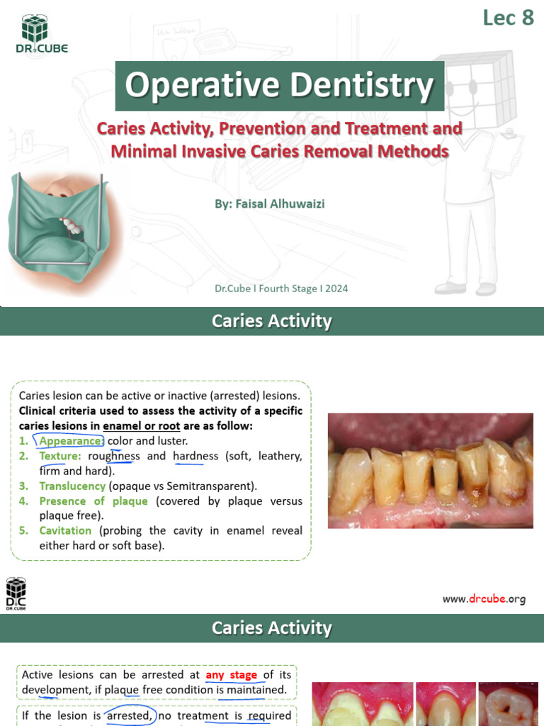 Operative4 Lec 10, P 2 Caries Activity, Prevention and Minimal Invasive ...