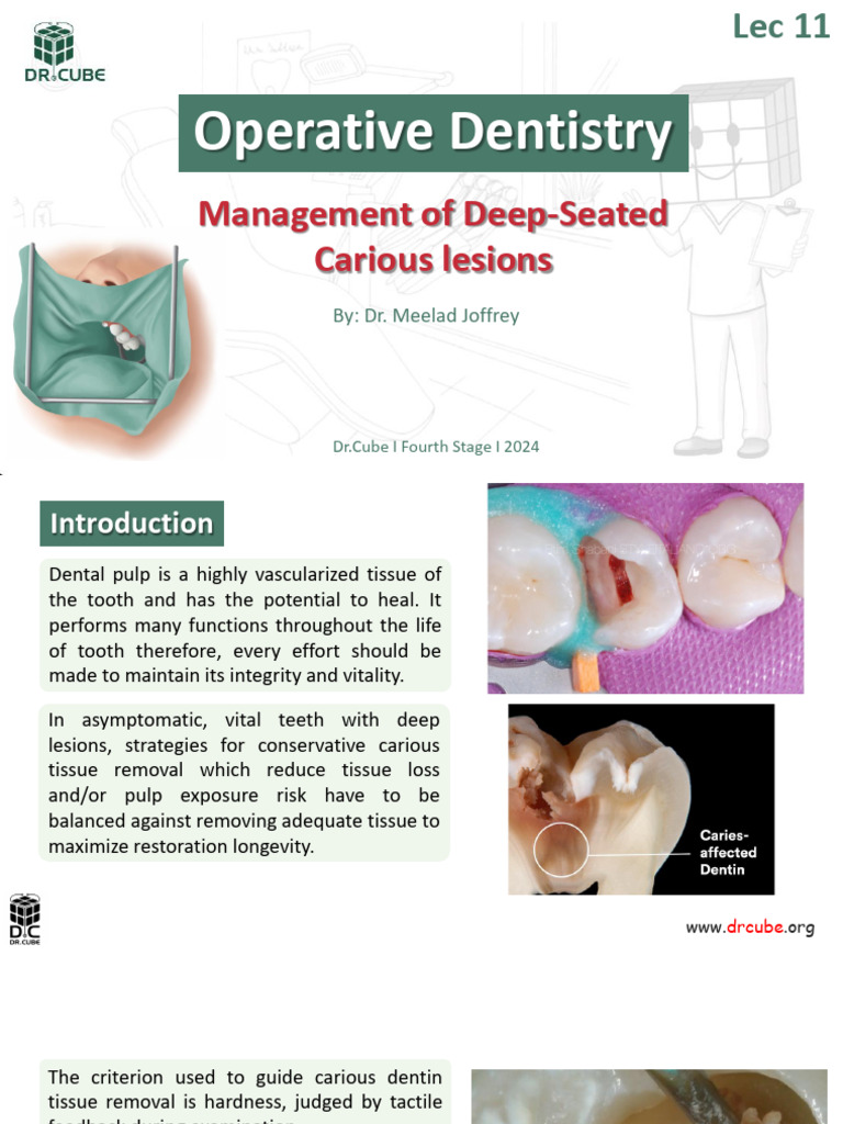 Operative4 Lec.9 Management of Deep-Seated Carious Lesions | PDF ...