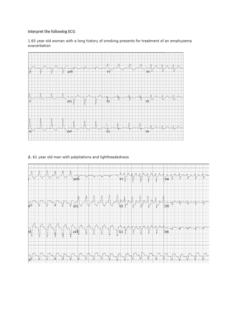 Interpret The Following ECG-for R | PDF