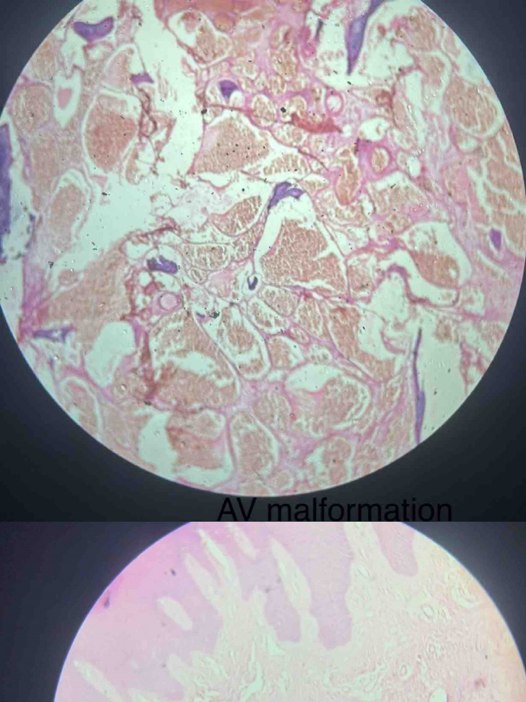 Oral Pathology Microscopic Slides | PDF