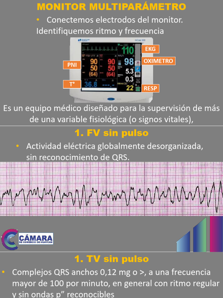 Guía de Uso de Monitores Médicos | PDF | Electrocardiografia | Sistema ...
