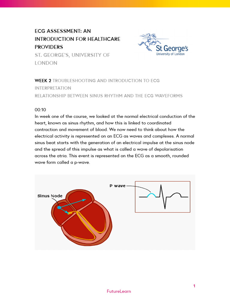 ECG W2 - Relationship Between Sinus Rhythm and ECG Waveforms | PDF ...