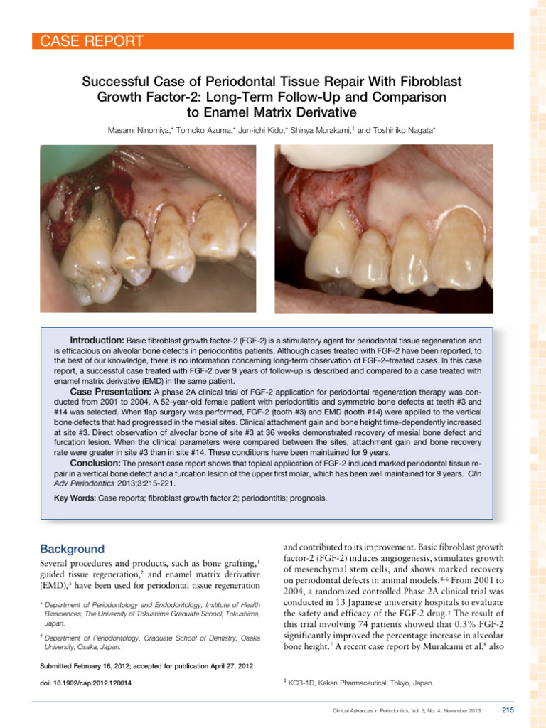 Clin Adv Periodontics - 2013 - Ninomiya - Successful Case of ...