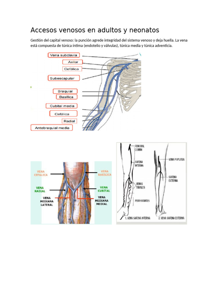 Accesos Venosos: Guía Completa | PDF | Feto | Terapia intravenosa