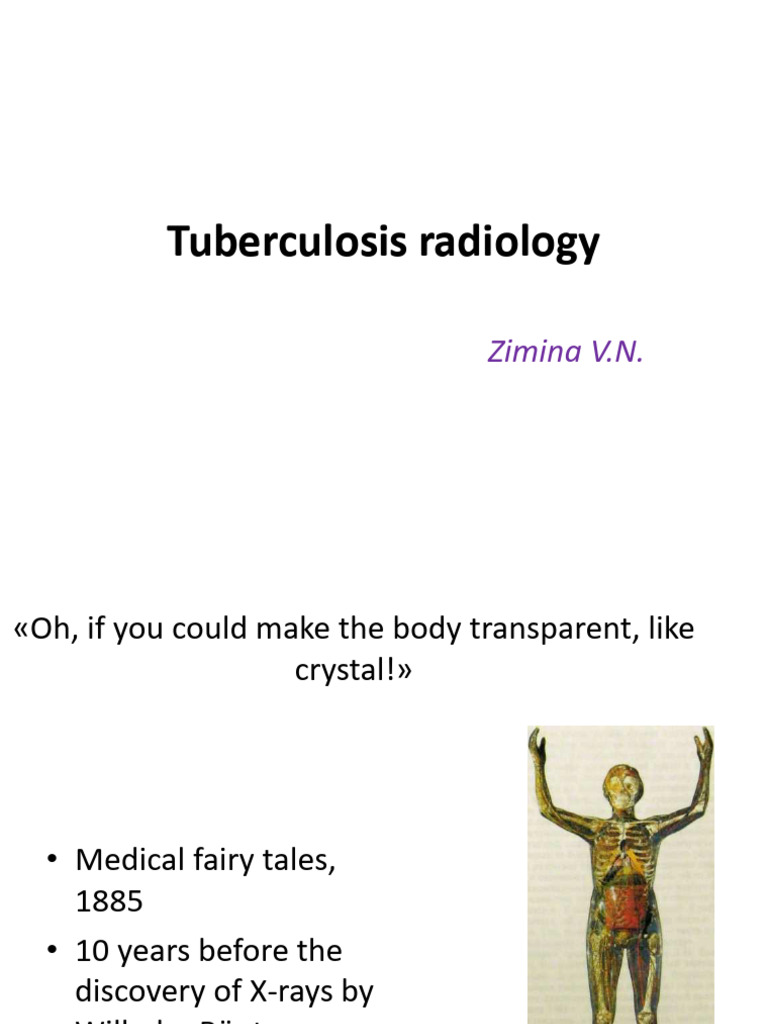 Radiological TB Diagnostics | PDF | Radiography | Ct Scan