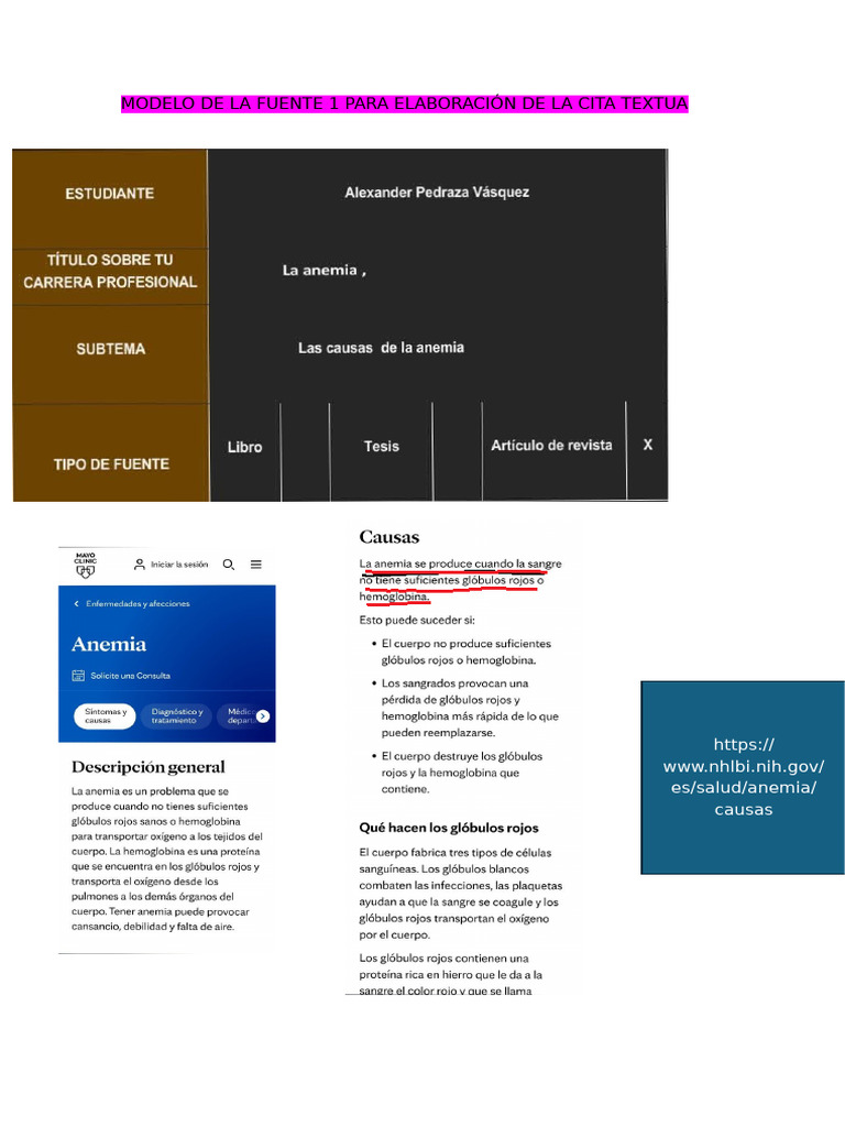 Alexander Pedraza Casuas de La Anemia | PDF