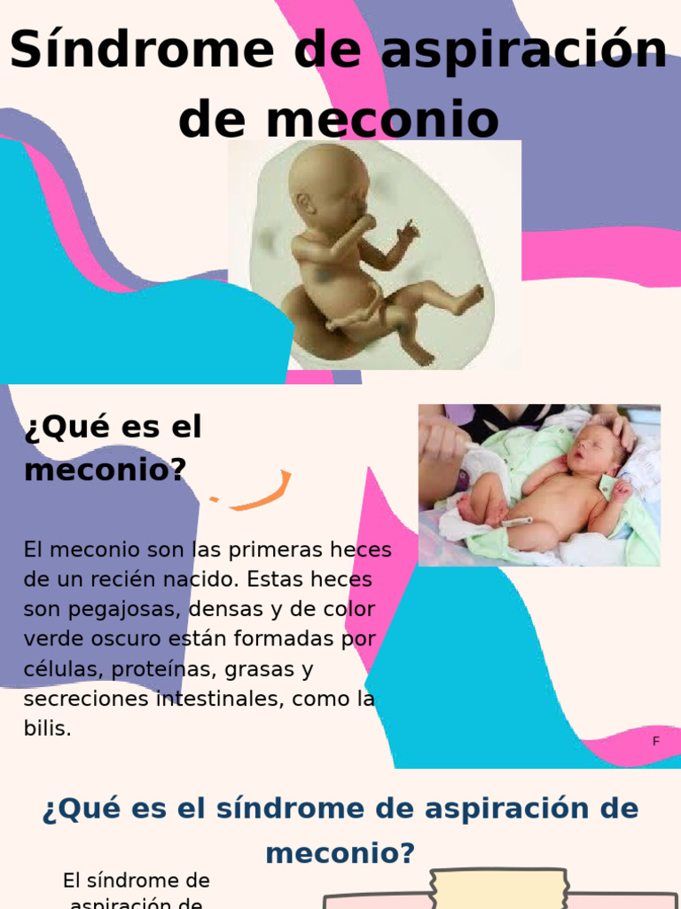 Síndrome de Aspiración de Meconio-1 | PDF | Especialidades Medicas ...