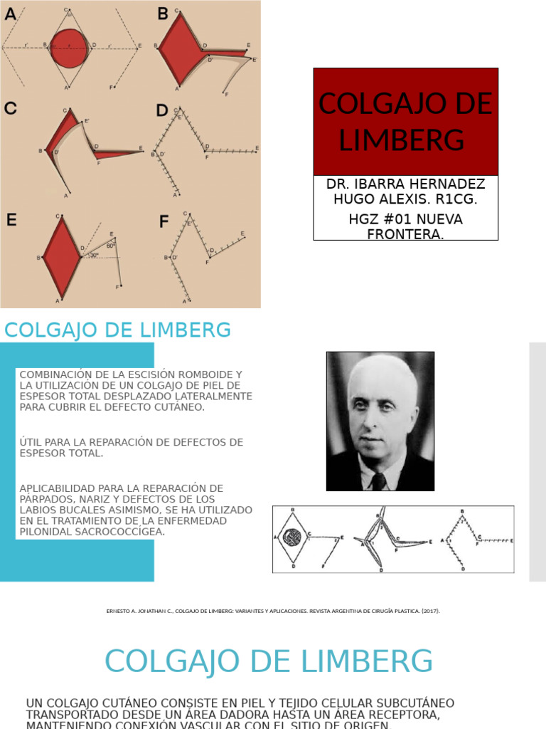 Colgajo de Limberg | PDF | Especialidades Quirúrgicas | Enfermedades y ...