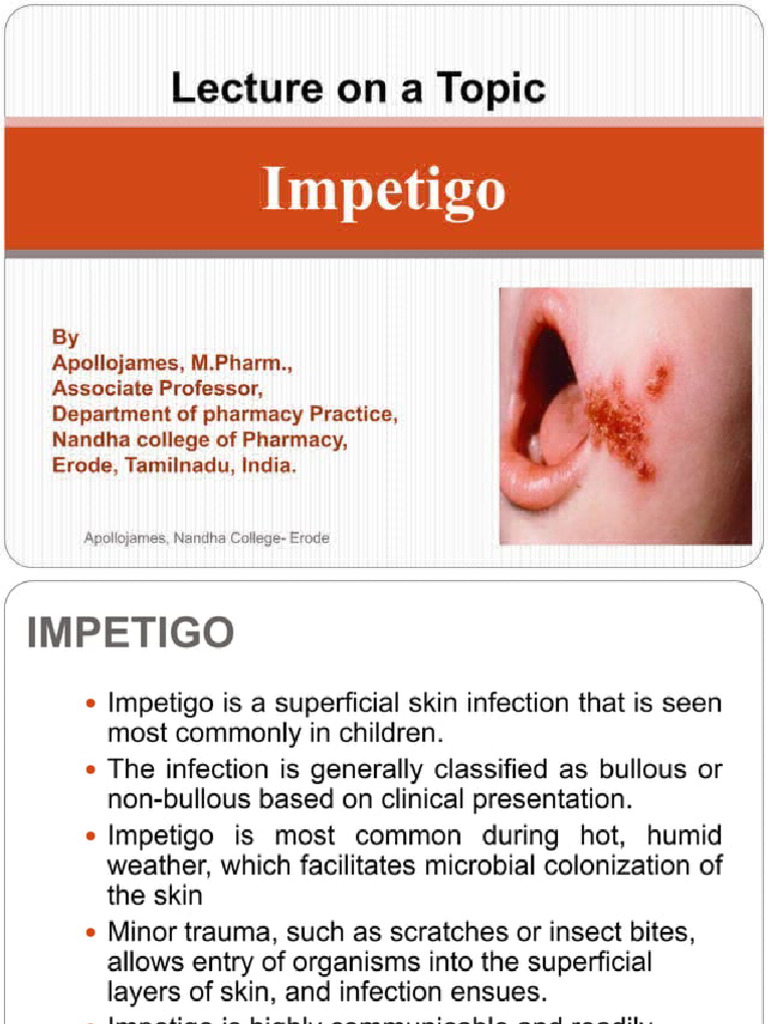 Impetigo 78 | PDF
