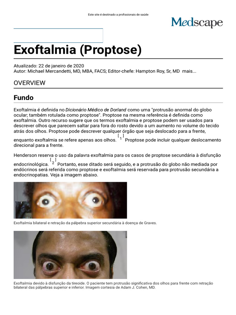 Exoftalmia (Proptose) - Contexto, Fisiopatologia, Epidemiologia | PDF ...