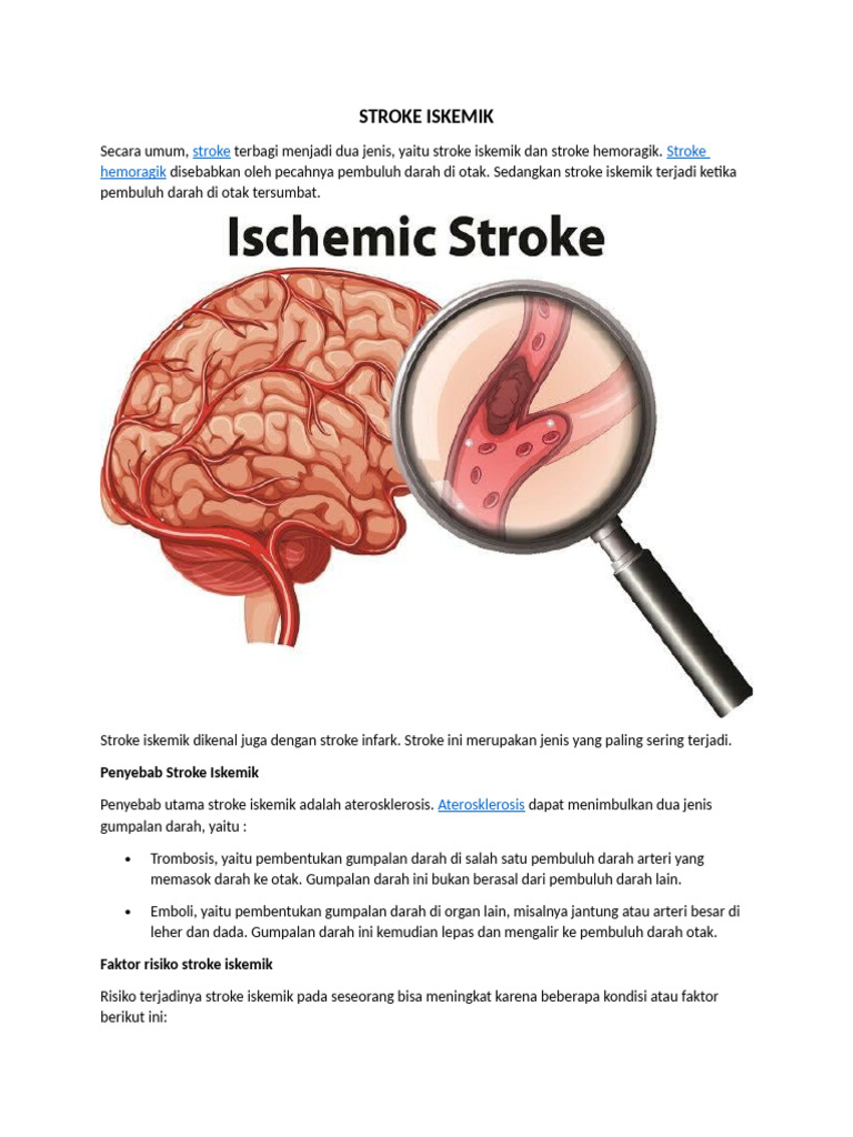 Stroke Iskemik | PDF | Sains & Matematika