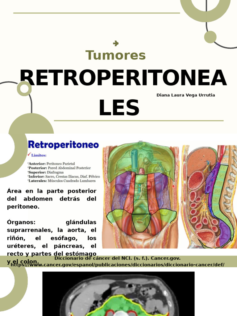 Tumores Retroperitoneales: Diagnóstico y Tratamiento | PDF | Sarcoma ...