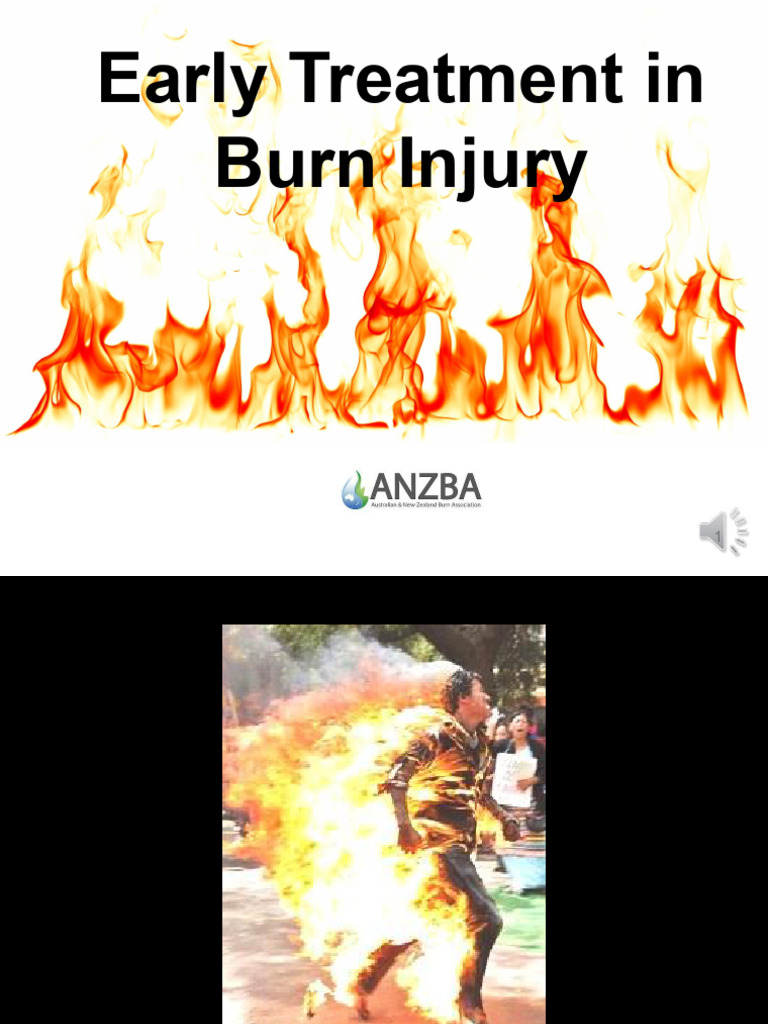 Kuliah Early Treatment in Burn Injury, FK UMSU (Ppt+Sound) | PDF