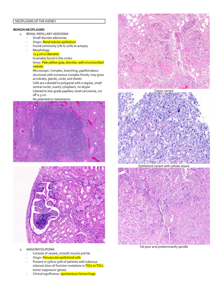 Kidney Neoplasms: Types and Characteristics | PDF | Causes Of Death ...