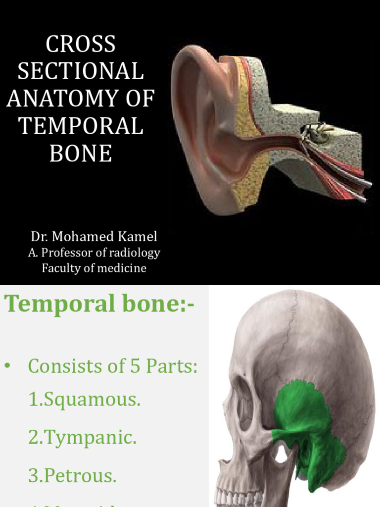 Temporal Bone Anatomy for Radiologists | PDF | Wellness | Science ...
