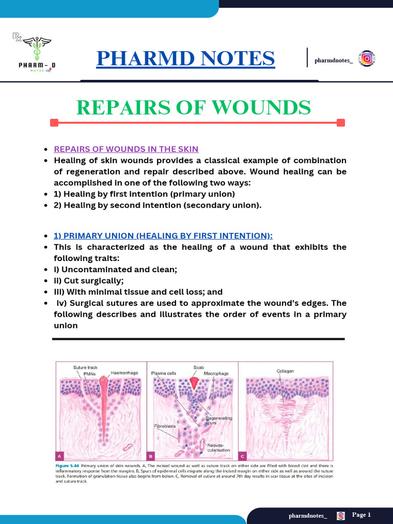 Repairs of Wounds - 20241031 - 155937 - 0000 | PDF | Healing | Wound ...