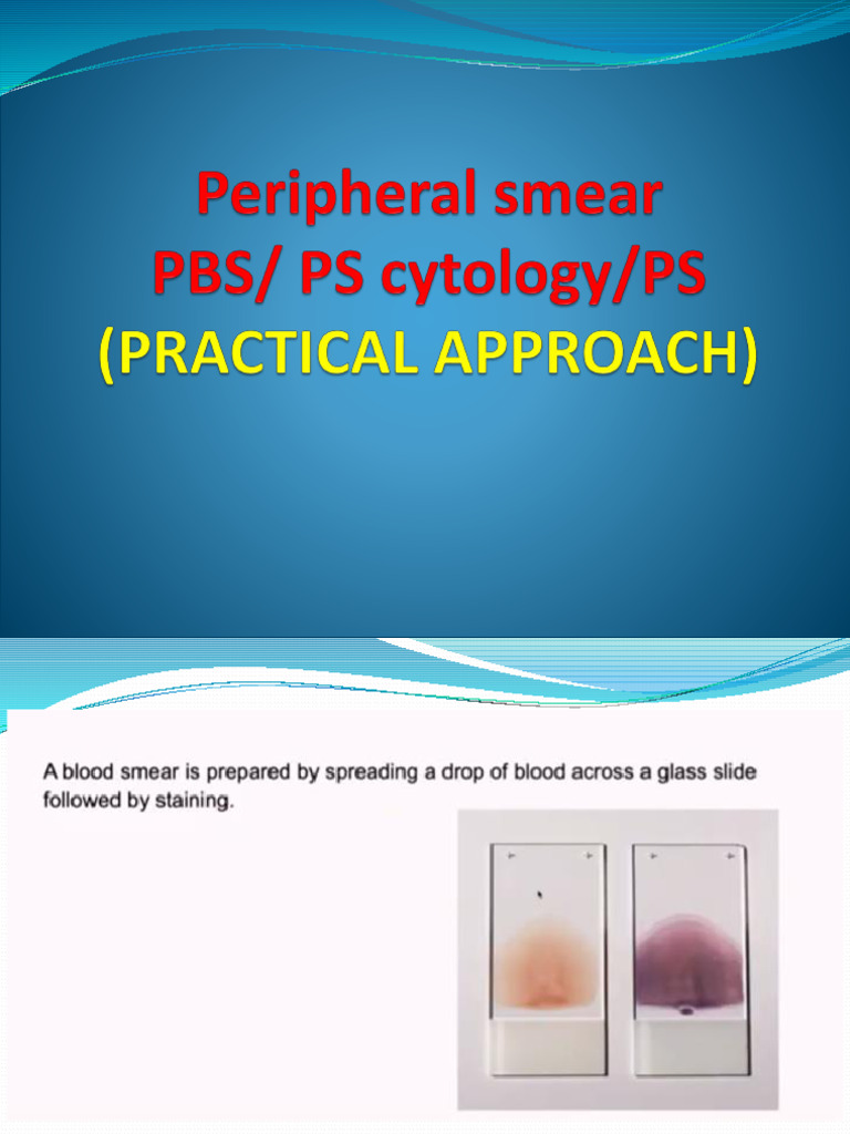 Peripheral Smear | PDF