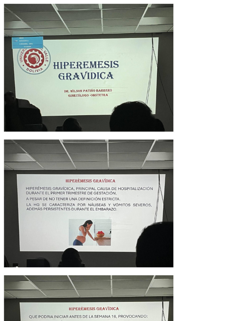 Hiperemesis Gravídica | PDF
