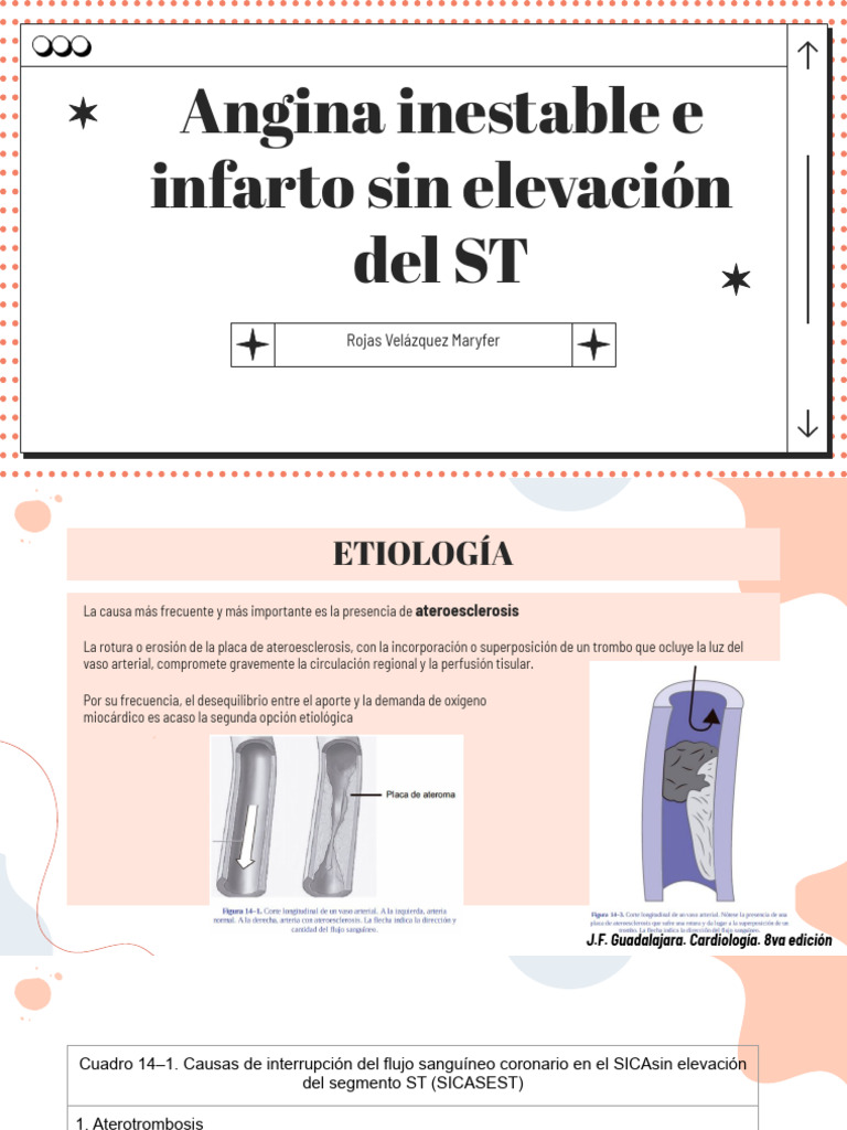 Angina Inestable e Infarto Sin Elevación Del ST | PDF | Infarto de ...