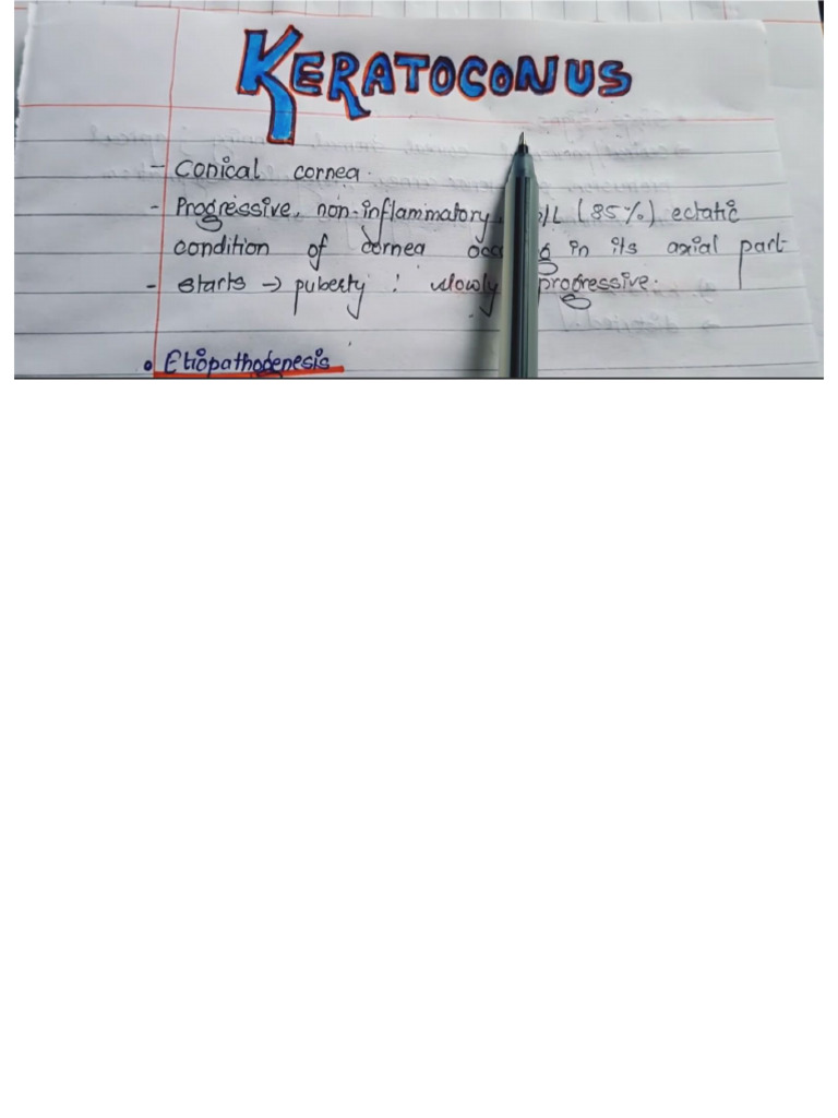 Keratoconus | PDF