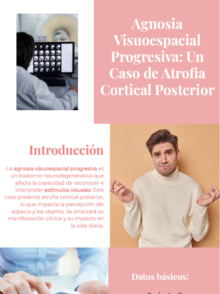 Diapositivas Act 4 GRUPAL | PDF | Demencia | Medicina CLINICA