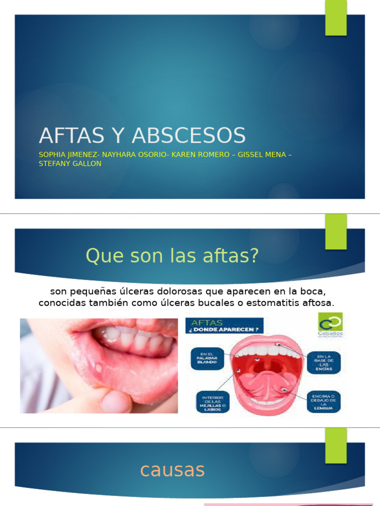 Aftas y Abscesos Bucales: Causas y Síntomas | PDF
