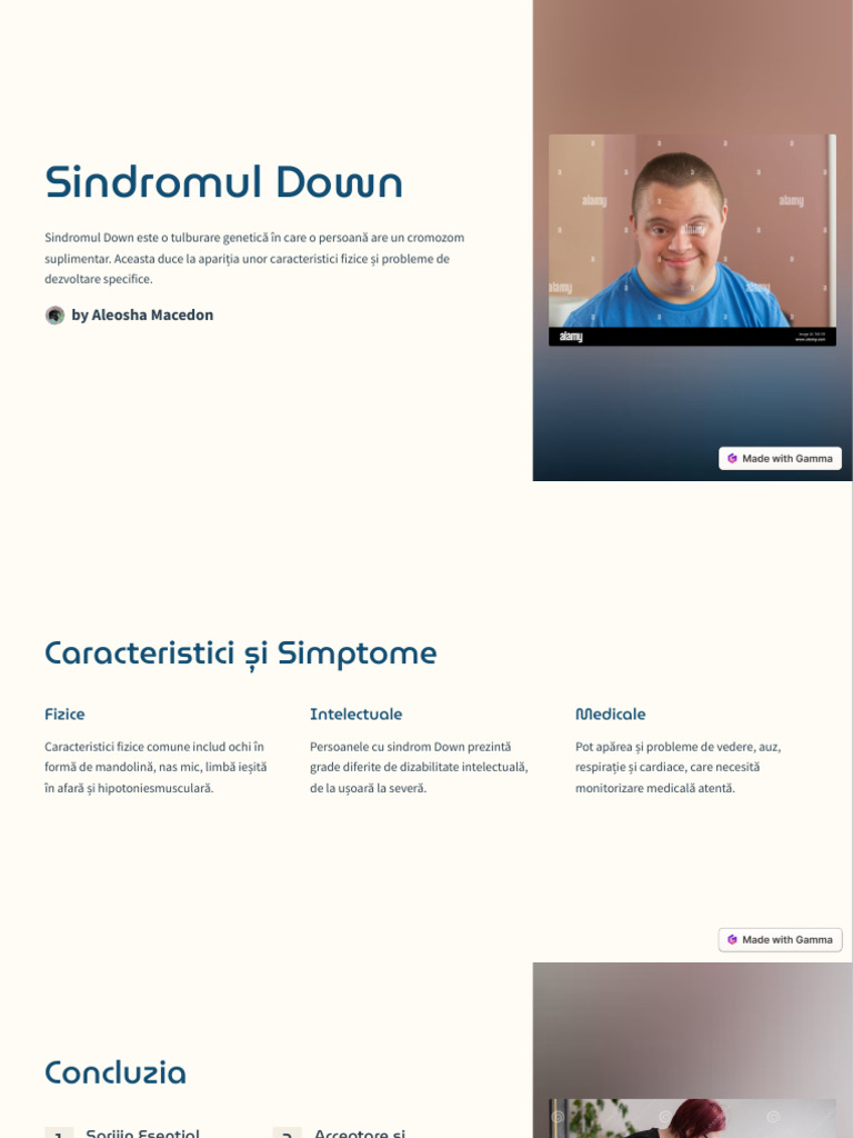 Sindromul Down: by Aleosha Macedon | PDF