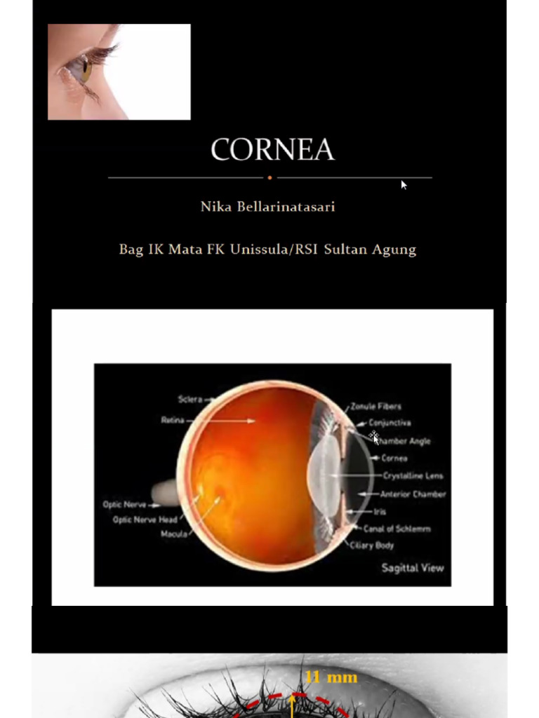 LBM 2 - Keratitis Dan Ulkus Kornea | PDF