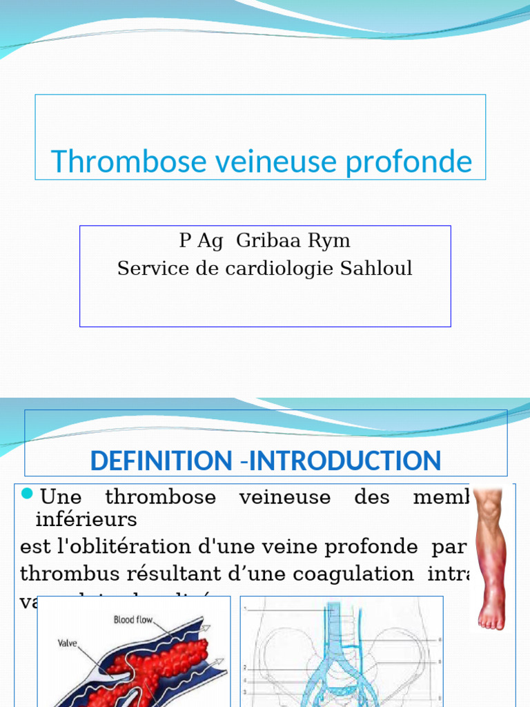 Thrombose Veineuse Profonde 1 2 | PDF | Hémostasie | Varices