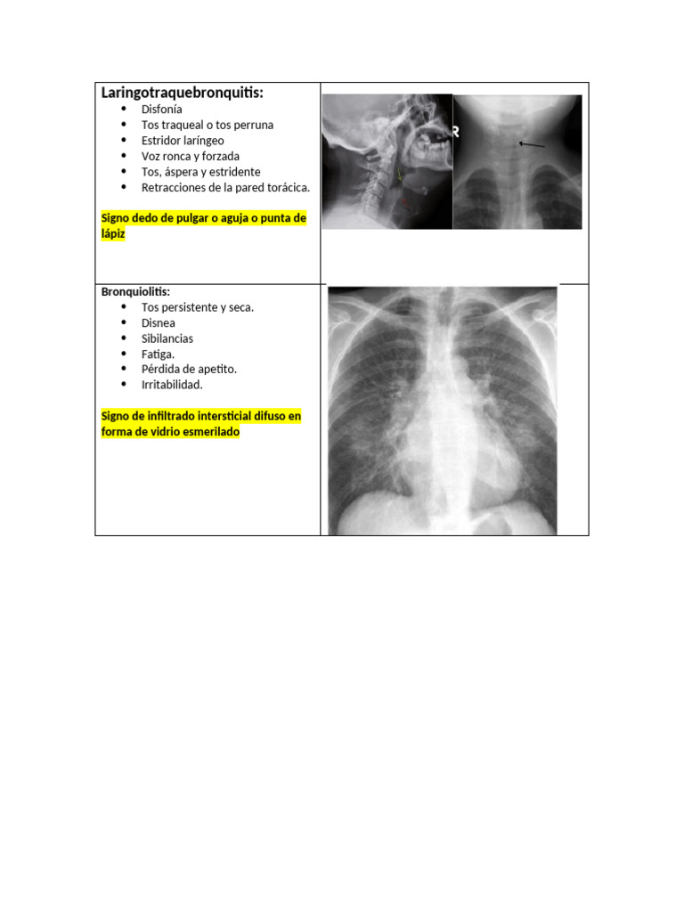 Signos Radiológicos de Vías Aéreas | PDF | Viajes y turismo