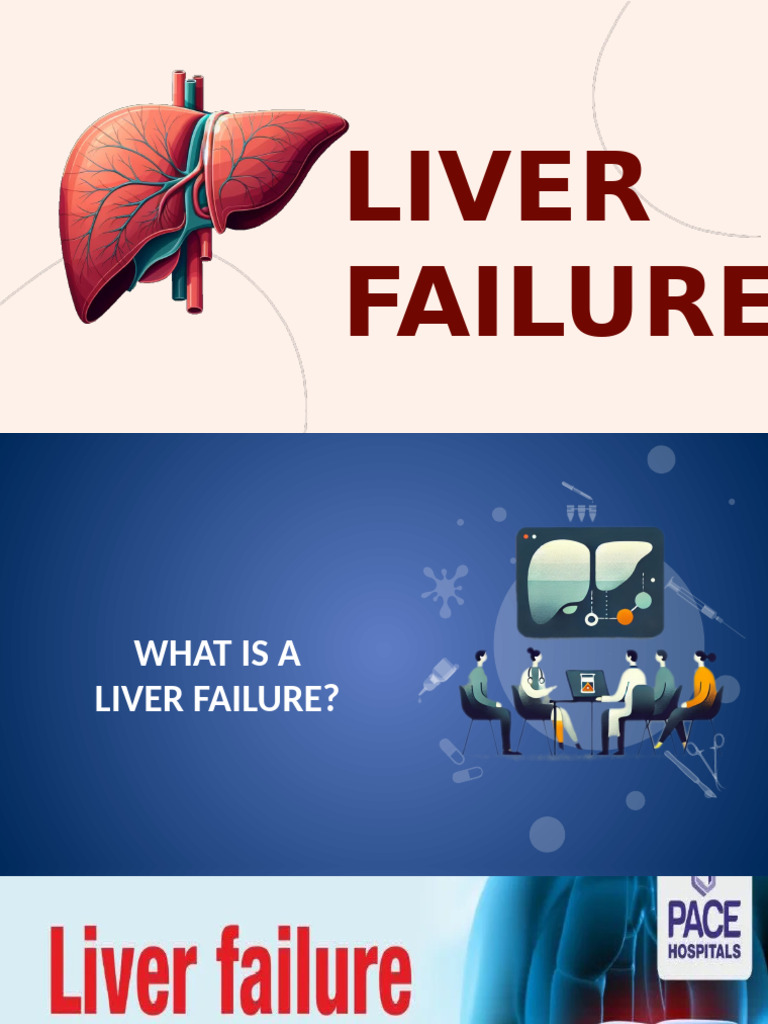 Understanding Liver Failure Types and Treatment | PDF | Cirrhosis | Liver