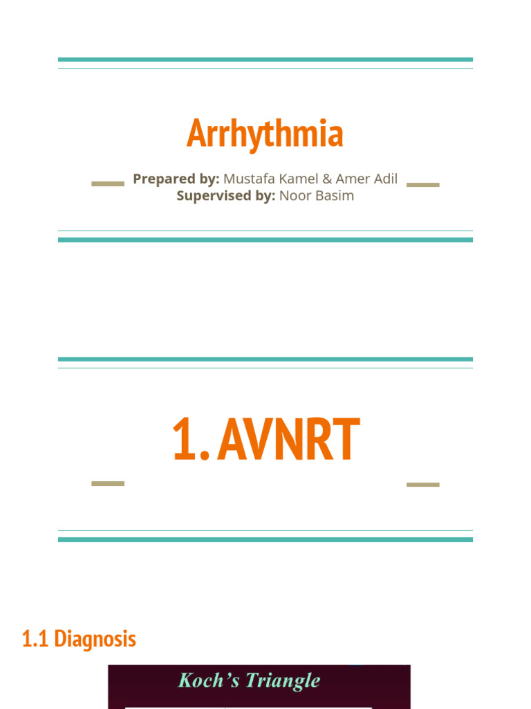 Arrhythmia Diagnosis and Ablation Guide | PDF