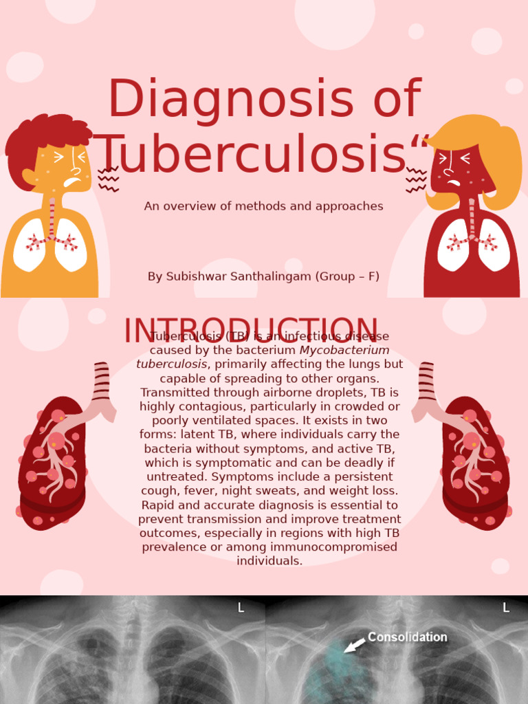 Diagnosis of TB - Subishwar Santhalingam (GRP-F) | PDF | Tuberculosis ...