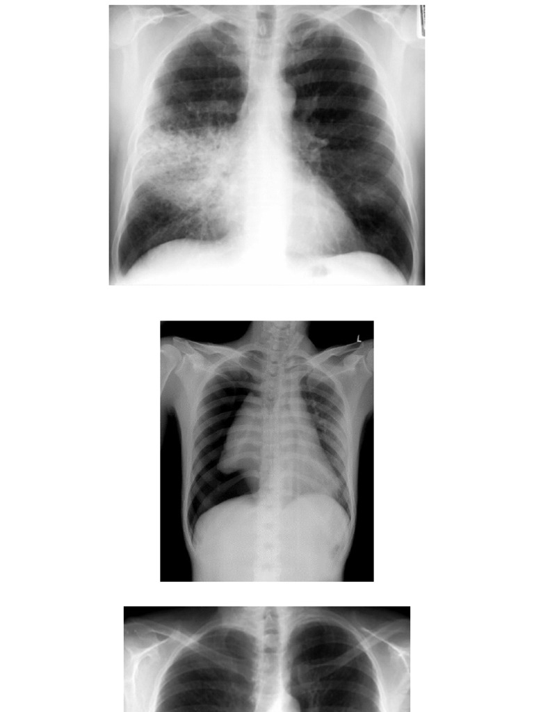 X Rays | PDF
