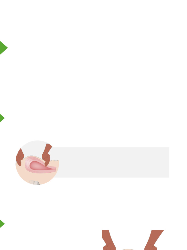 Slides Postpartum Complications Subinvolution Nursing | PDF