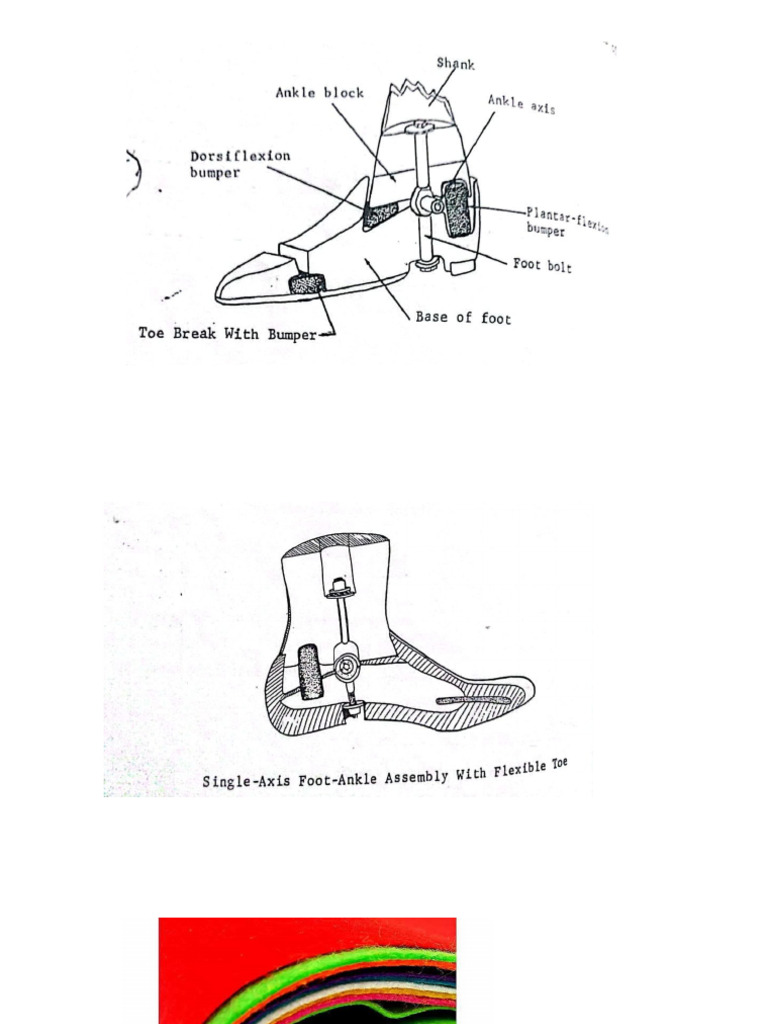 Images of Below Knee Prosthesis and Components | PDF