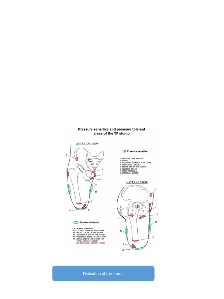 Fabrication of Below Knee Prosthesis | PDF