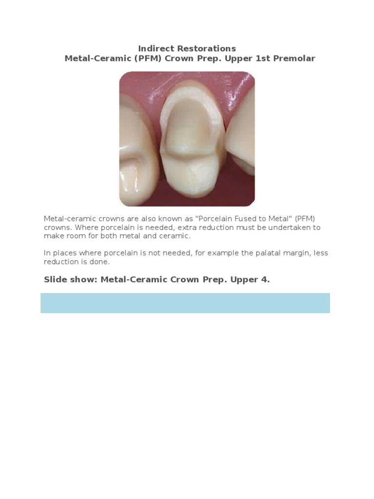 Pfm Crown Prep Dimensions