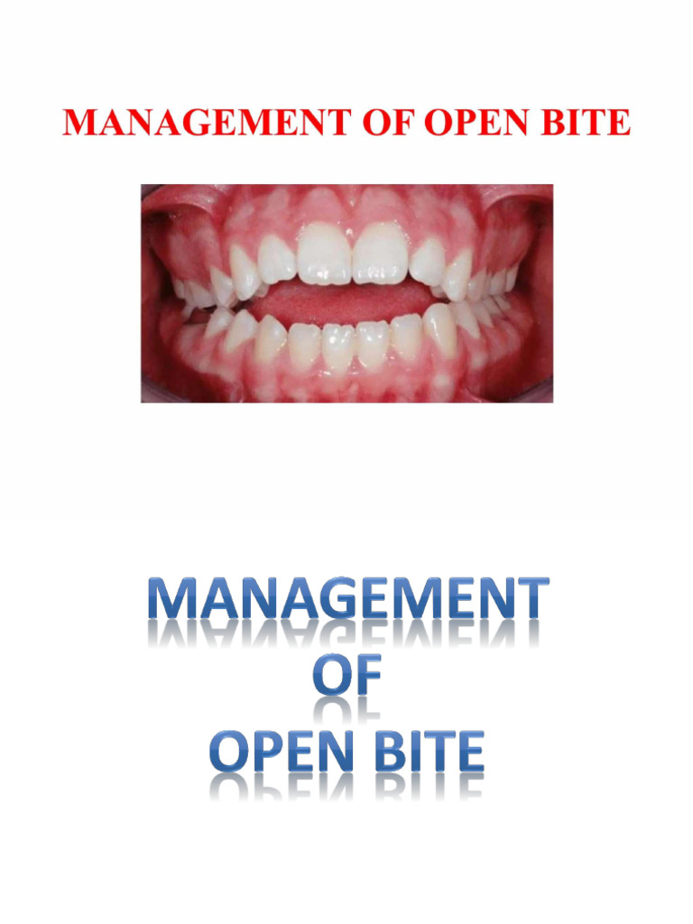Management Strategies for Open Bite | PDF | Wellness | Science ...