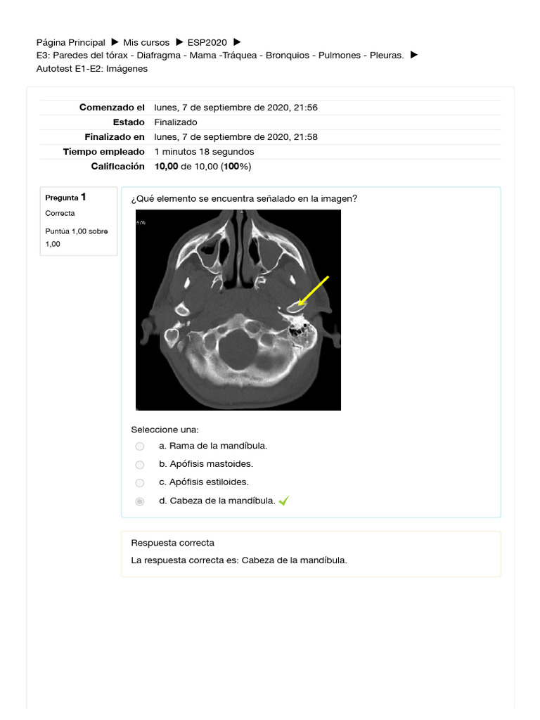 Autotest E1-E2 - Imágenes | PDF | Anatomía humana | Tejido suave