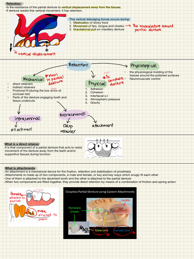 6 - Direct Retention of RPD I | PDF | Dentures | Dentistry Branches