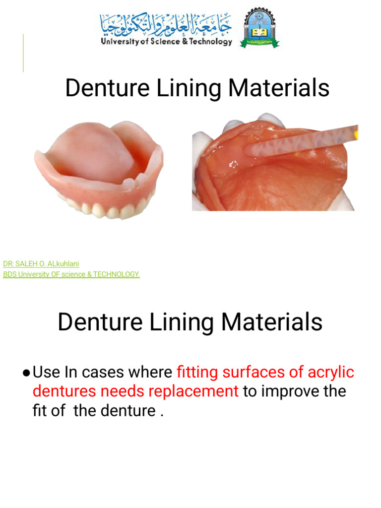 Denture Lining Materials | PDF | Dentures | Poly(Methyl Methacrylate)