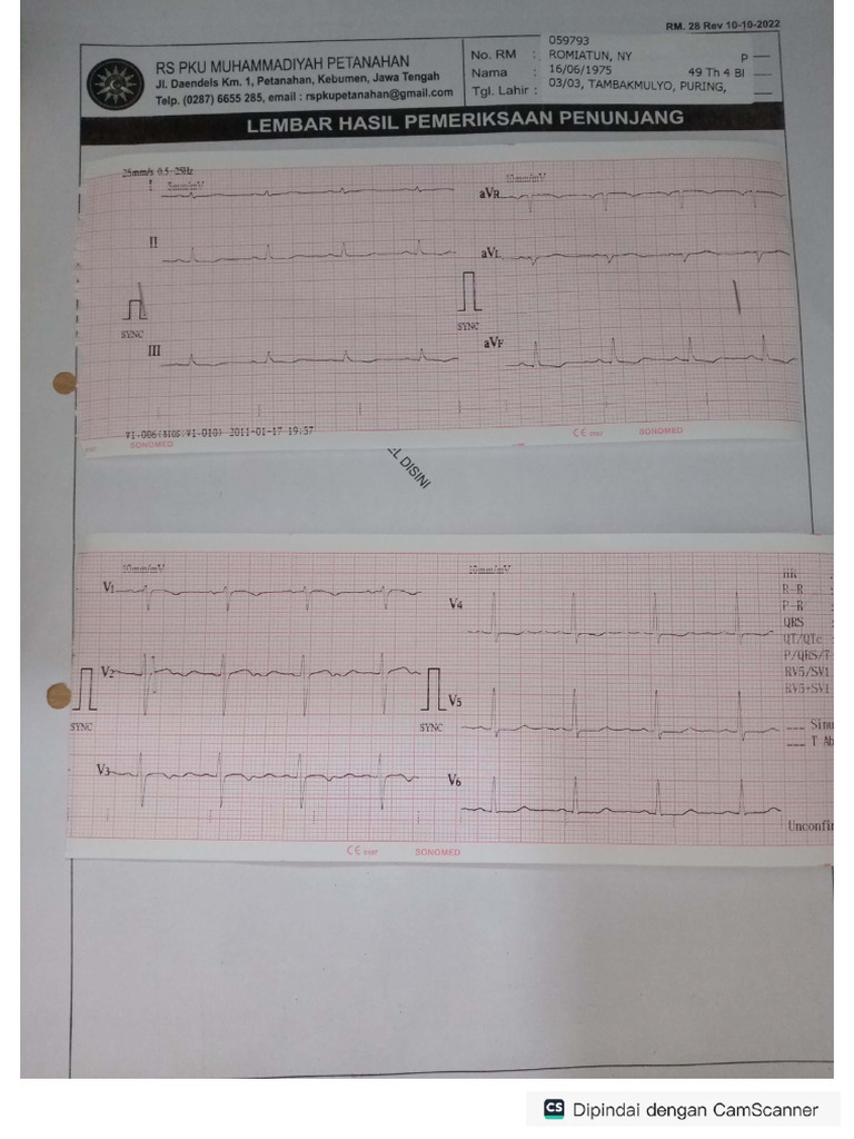 Ny. Romiatun Ekg 2 | PDF