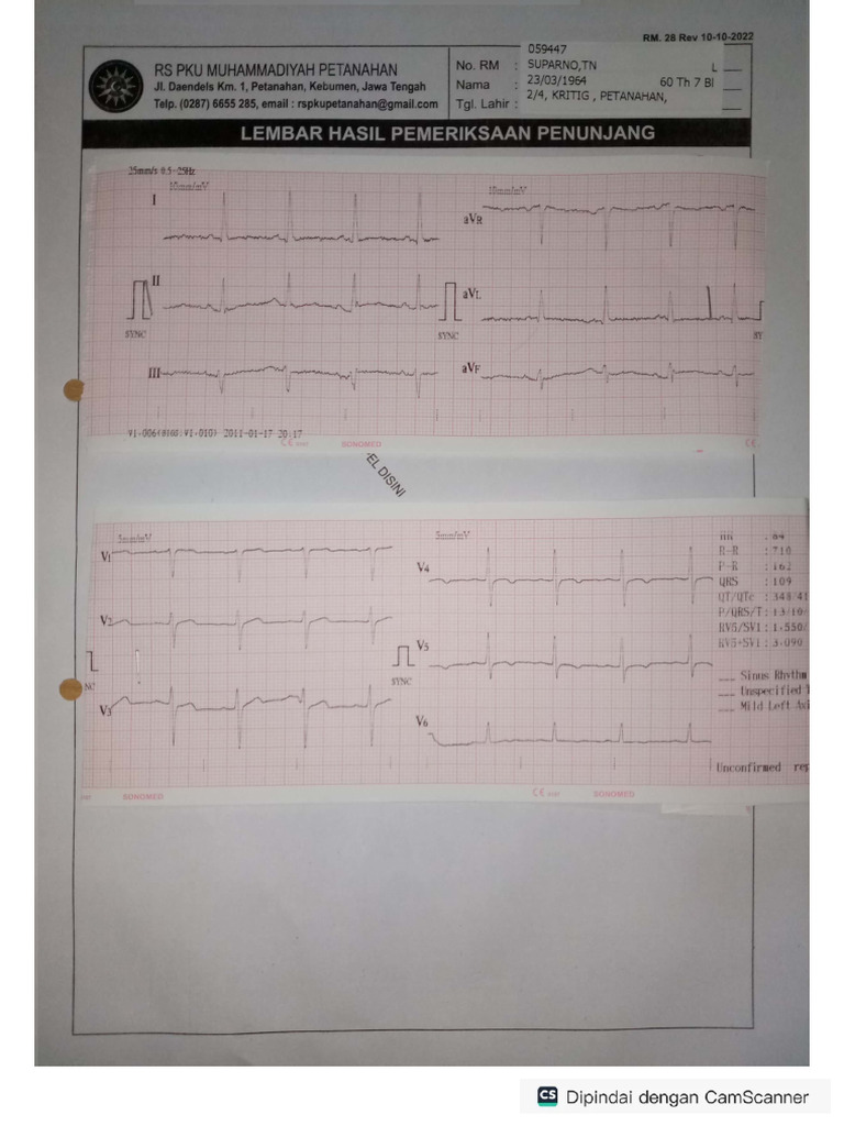 Tn. Suparno Ekg | PDF