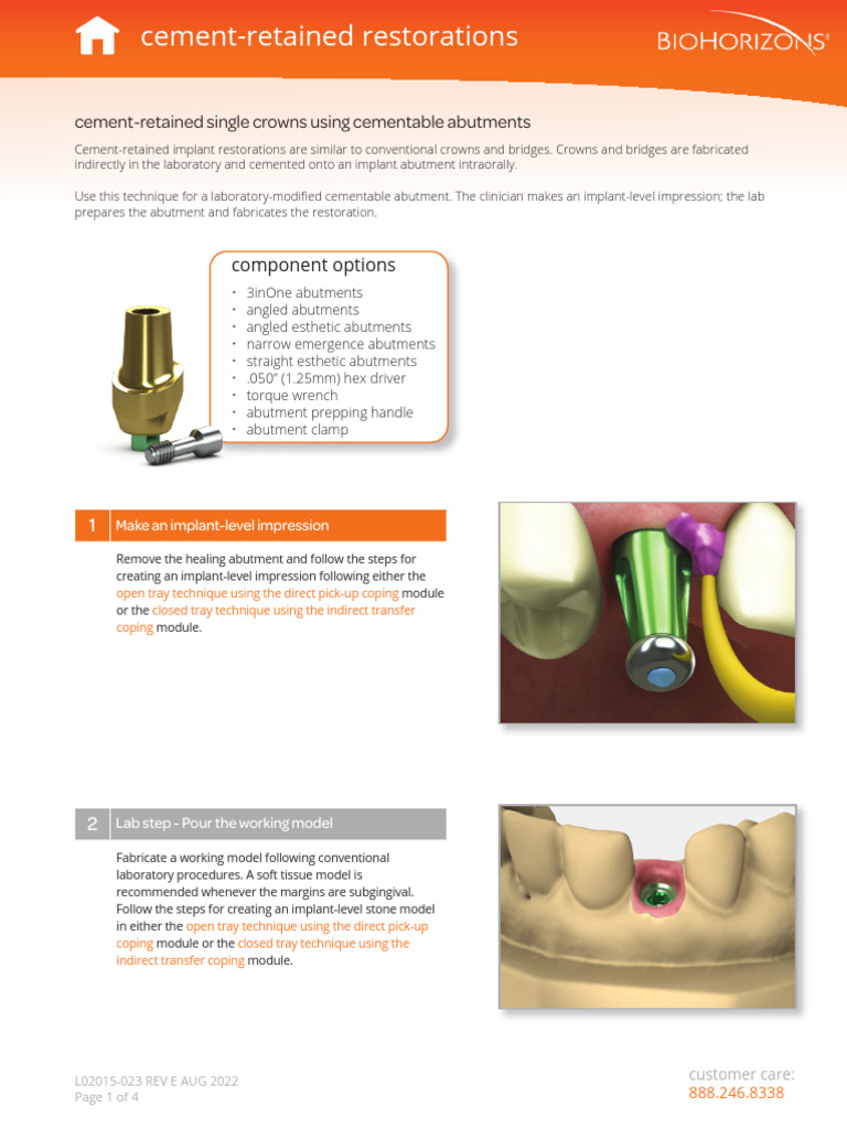 Biohorizon Cement Retained | PDF | Dental Implant | Dentistry Branches