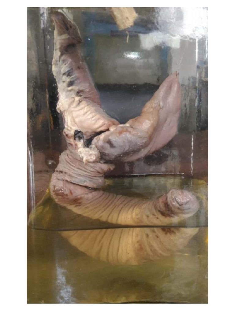 Surgery Specimens | PDF | Home & Garden | Science & Mathematics