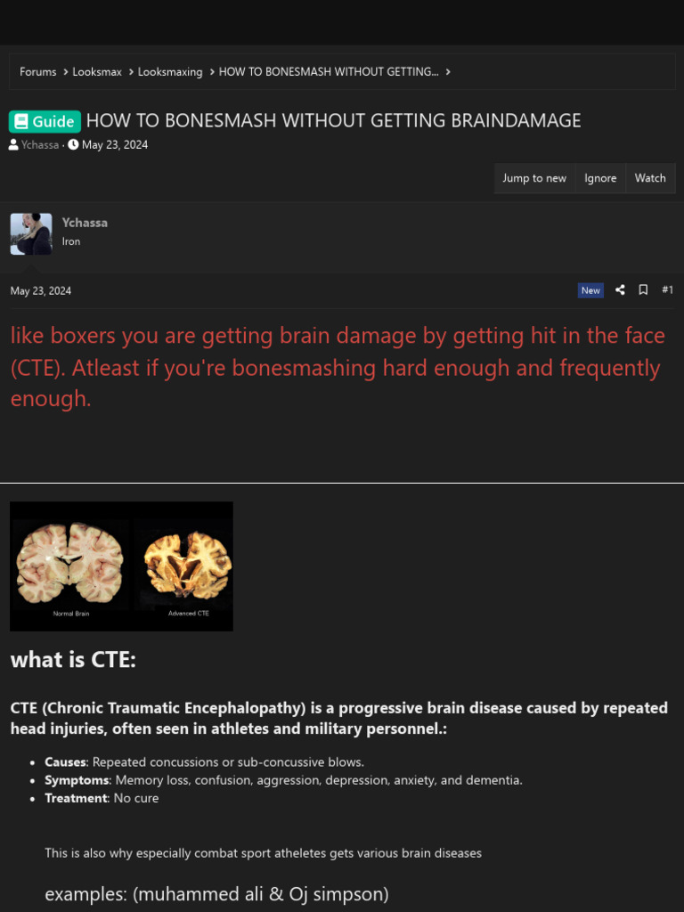 HOW TO BONESMASH WITHOUT GETTING BRAINDAMAGE - Looksmax - Org - Men's ...