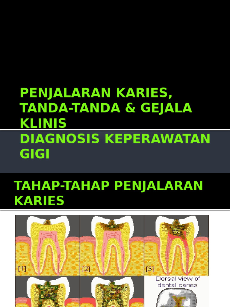 Tanda-Tanda Klinis Diagnosis Keperawatan Gigi | PDF | Sains & Matematika