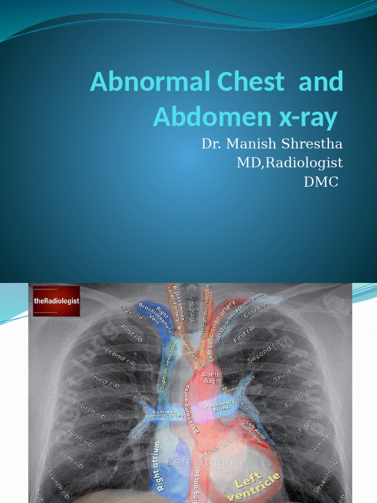 Abnormal Chest and Abdomen - Xray | PDF | Lung | Clinical Medicine