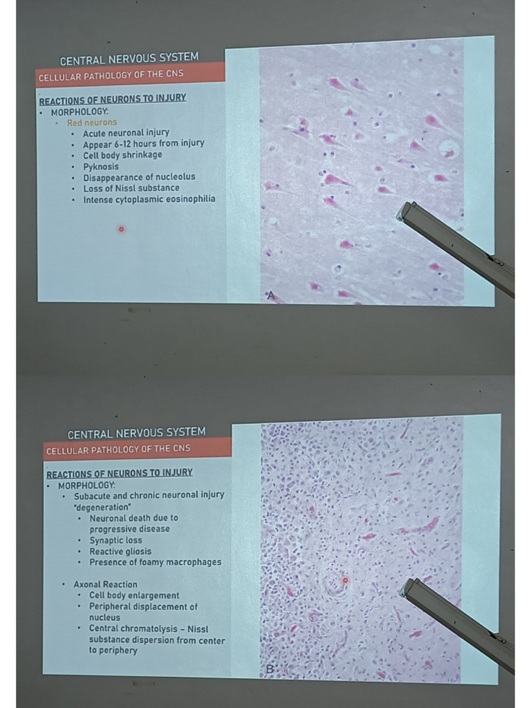 Genpath Lec - Cns | PDF